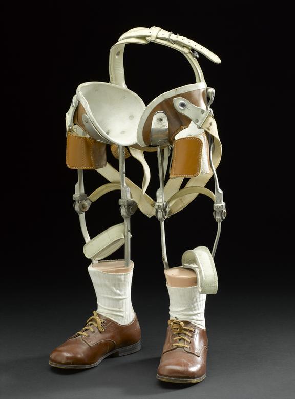 Pair of artificial legs worn by Ed Freeman | Science Museum Group ...
