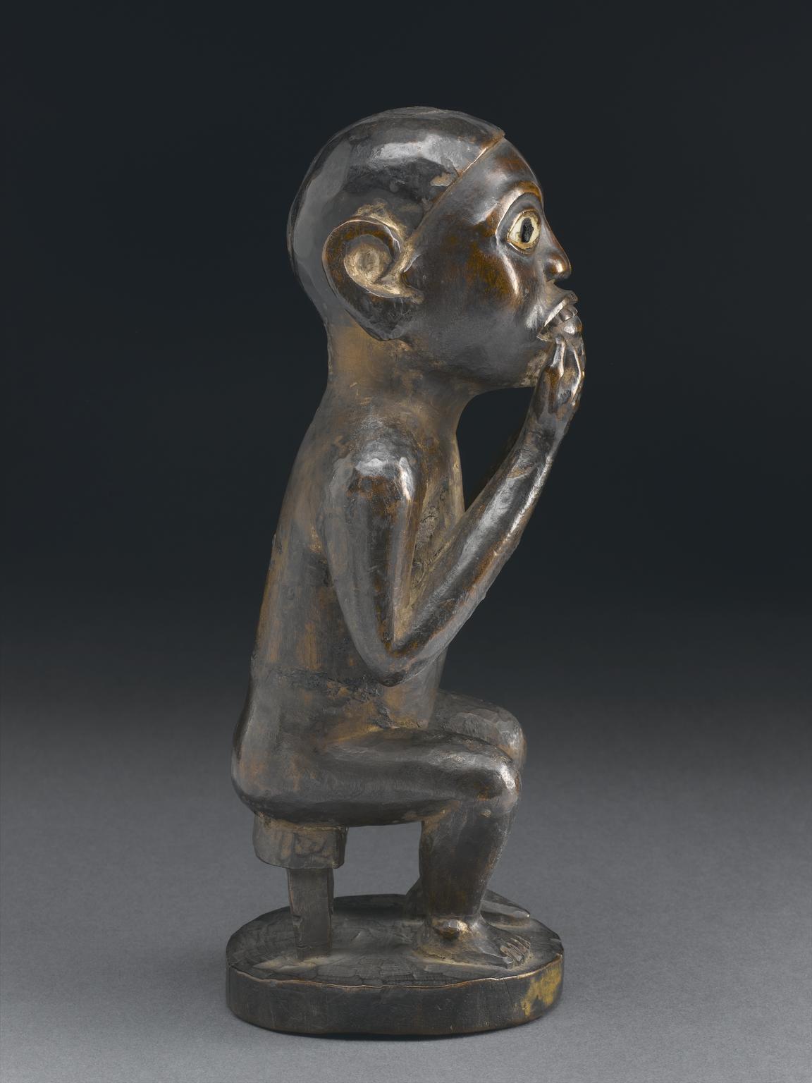 Wooden statue possibly showing macroglossia, Democratic Republic of ...
