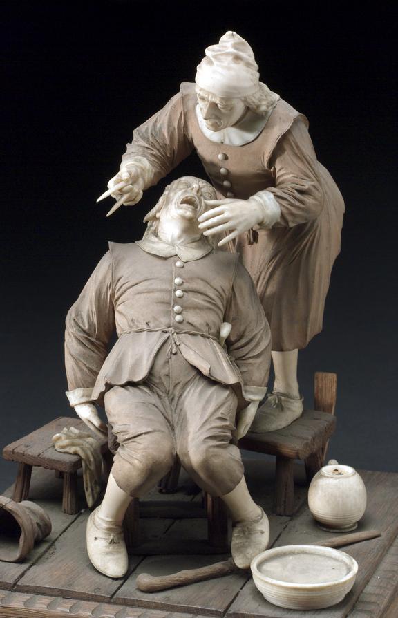 Statue showing a tooth extraction, Europe, 1601-1700 | Science Museum ...