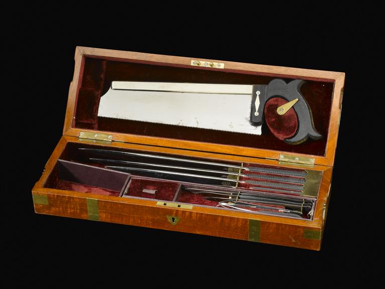 Amputation instrument set, London, England, 1831-1870 | Science Museum ...