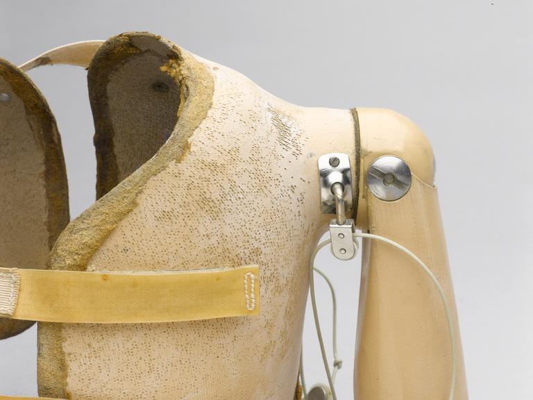 Pair of artificial/prosthetic arms for a child living with thalidomide ...