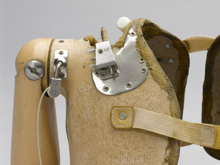Pair of artificial/prosthetic arms for a child living with thalidomide ...
