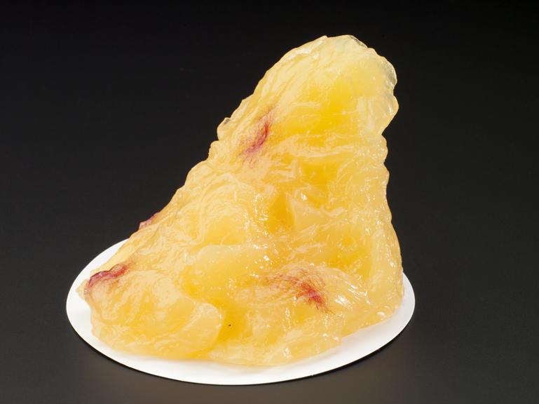 One pound of human fat plastic replica model | Science Museum Group ...
