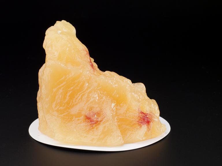 One pound of human fat plastic replica model | Science Museum Group ...