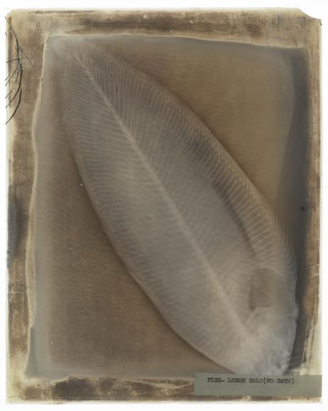 Early x-ray glass plates | Science Museum Group Collection