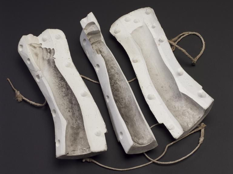 Plaster five-part arm mould | Science Museum Group Collection