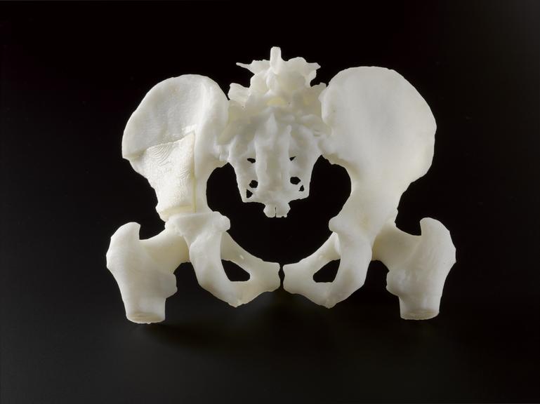 3D printed bone scaffold | Science Museum Group Collection