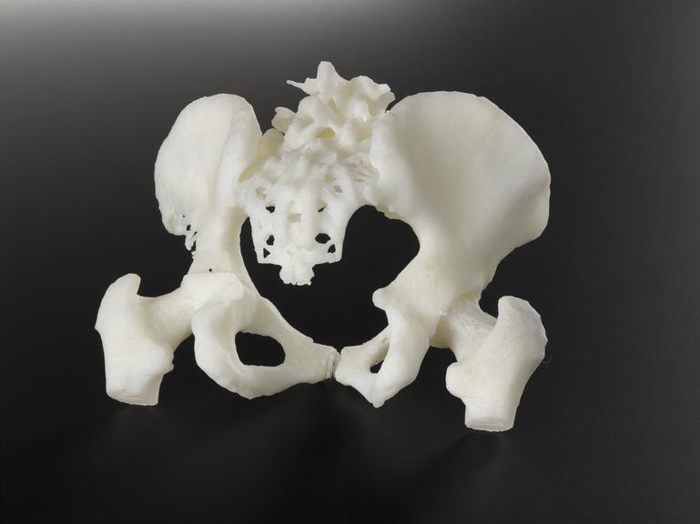 3D printed bone scaffold | Science Museum Group Collection