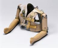 Pair of prosthetic/artificial arms for a child living with thalidomide ...