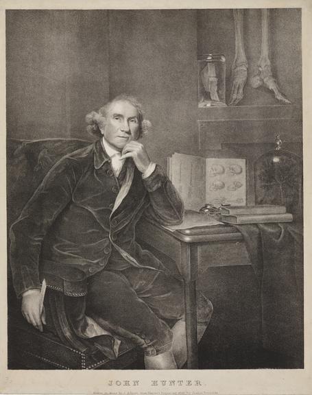 Portrait of John Hunter (1728-1793) surgeon, United Kingdom, 1830-1839 ...