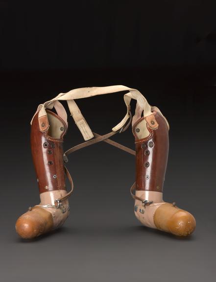 A pair of arms made for a 2 year old girl who was born with bilateral ...