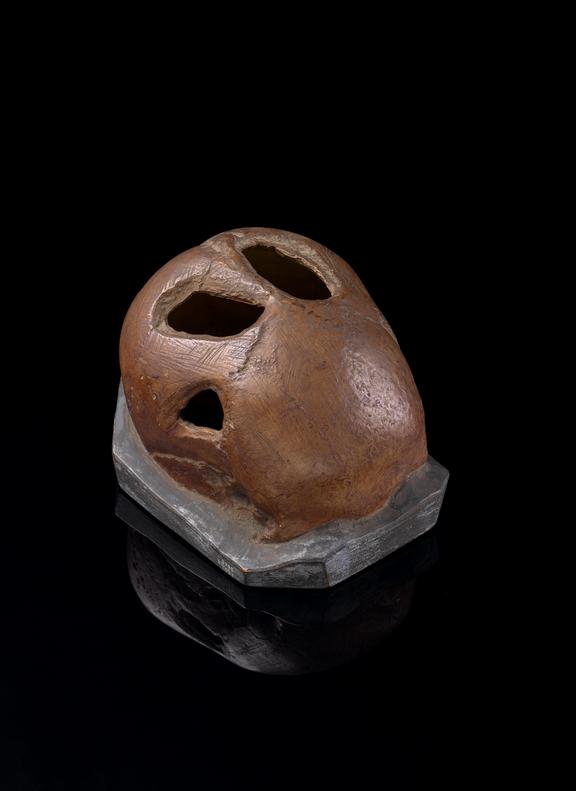 Plaster cast of trephined skull | Science Museum Group Collection