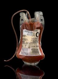 Blood plasma bag, labelled 'O', containing theatrical blood | Science ...
