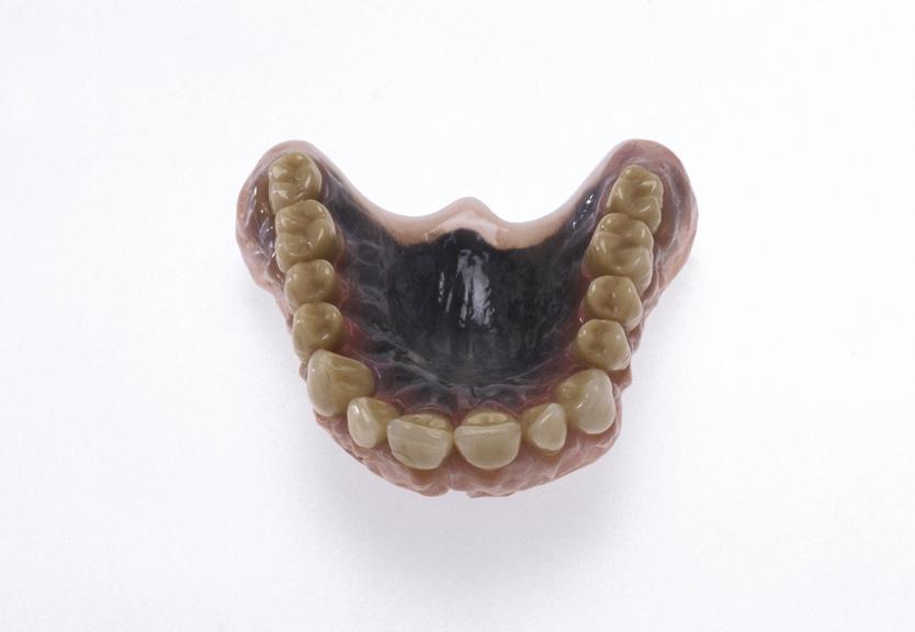 Upper set of false teeth | Science Museum Group Collection