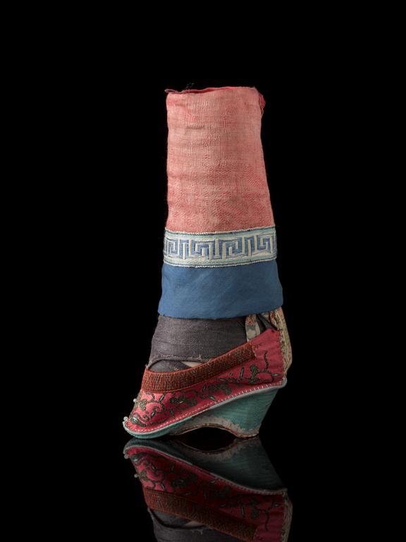 Cast of Chinese lady's deformed foot with legging and embroidered shoe ...