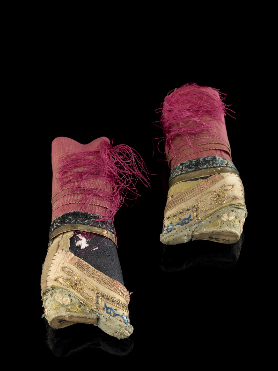 Pair of casts of deformed feet in shoes | Science Museum Group Collection