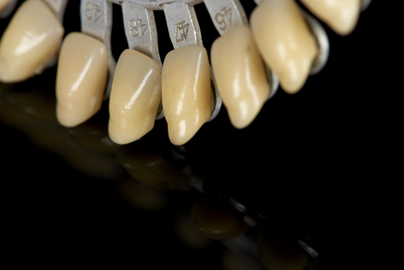 Shade guide for "Solarex" porcelain teeth | Science Museum Group Collection