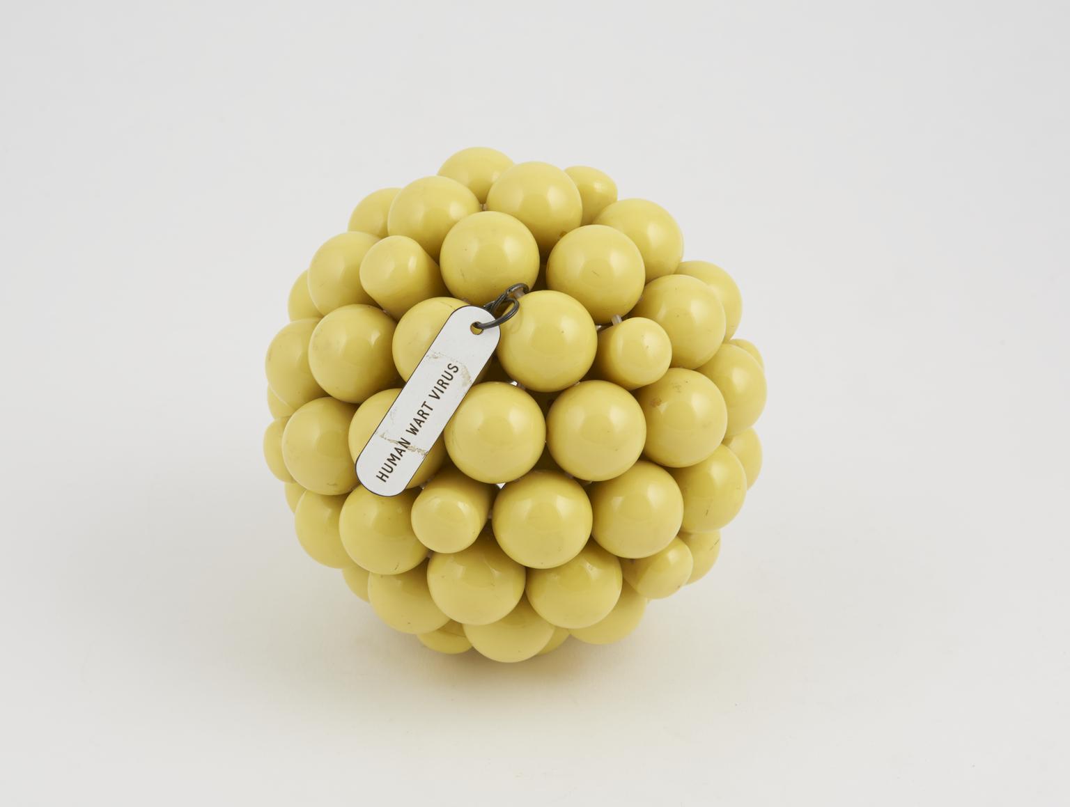 Ball and spoke model of human wart virus (yellow) made at the ...