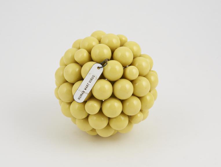 Ball and spoke model of human wart virus (yellow) made at the ...