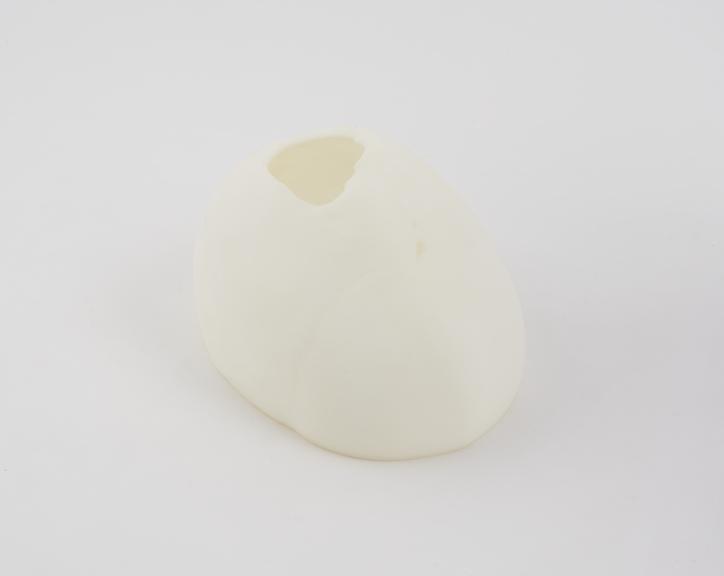3D printed bone scaffold | Science Museum Group Collection
