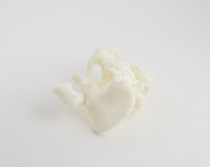 3D printed bone scaffold | Science Museum Group Collection