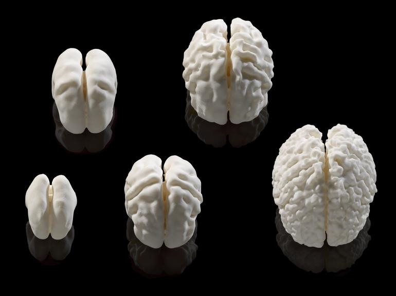 3D printed model of a healthy fetal brain at 29 weeks gestation ...