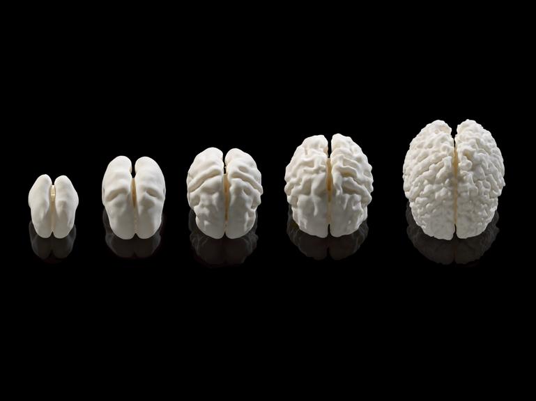 3D printed model of a healthy fetal brain at 29 weeks gestation ...