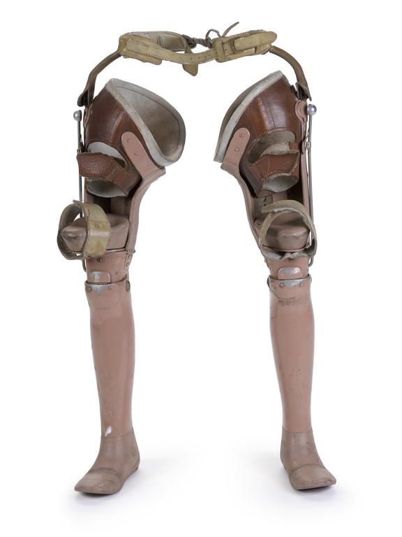 Prosthetic/artificial limbs used by Tracey Baynam | Science Museum ...