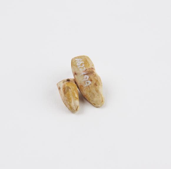 Etruscan denture | Science Museum Group Collection