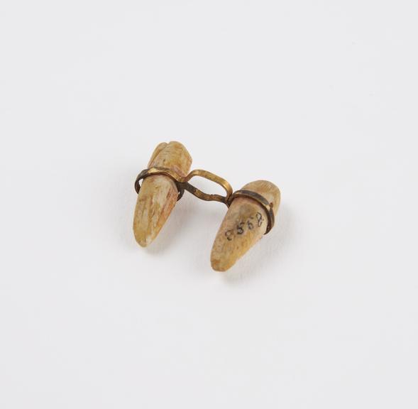Denture with 2 teeth, copy, original Etruscan | Science Museum Group ...