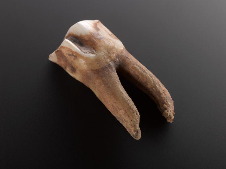 Large animal tooth carried to cure toothache | Science Museum Group ...
