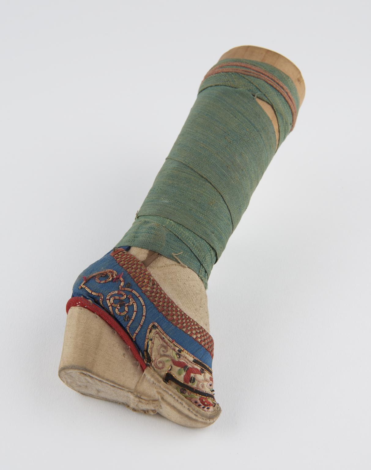 Model of Chinese lady's deformed foot with lower leg wearing shoe ...