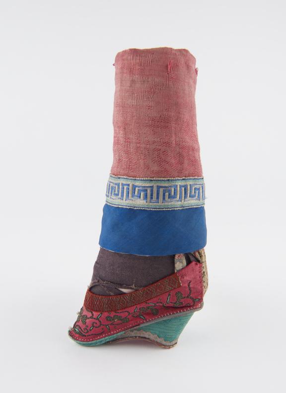 Cast of Chinese lady's deformed foot with legging and embroidered shoe ...