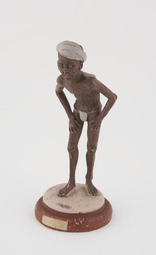 Model of an emaciated man with turban | Science Museum Group Collection