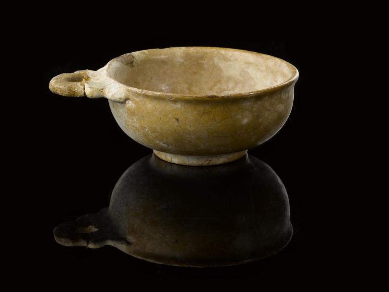 Earthenware bleeding bowl | Science Museum Group Collection
