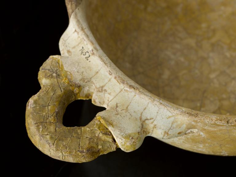 Earthenware bleeding bowl | Science Museum Group Collection