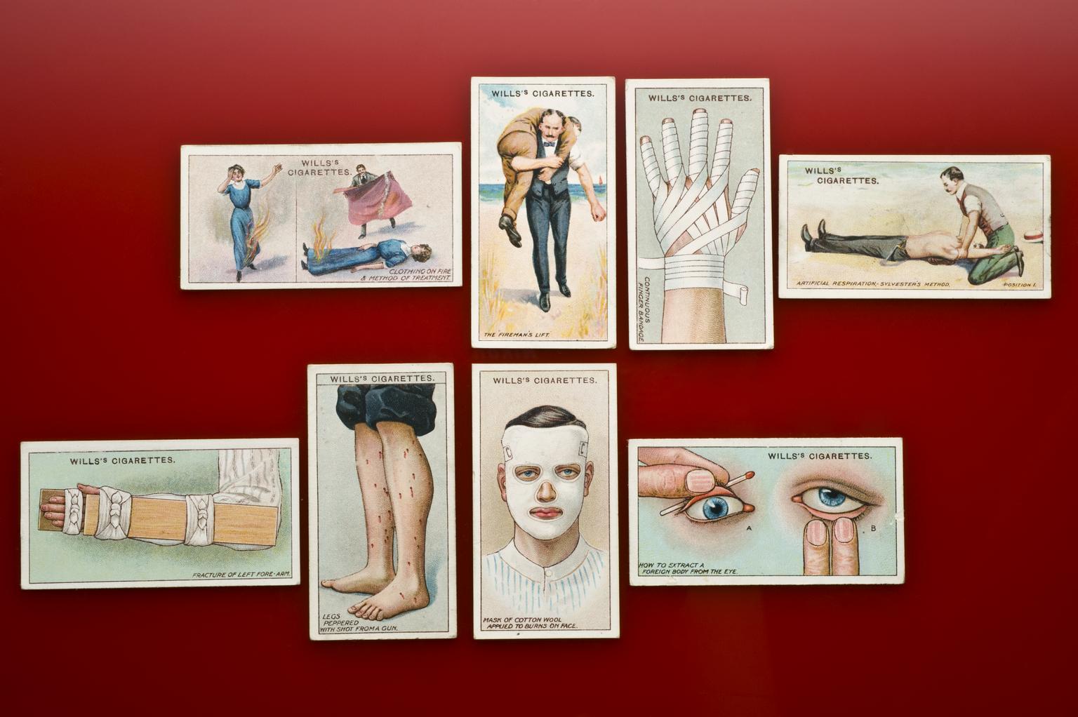 'First Aid' cigarette card showing how to remove foreign bodies from ...
