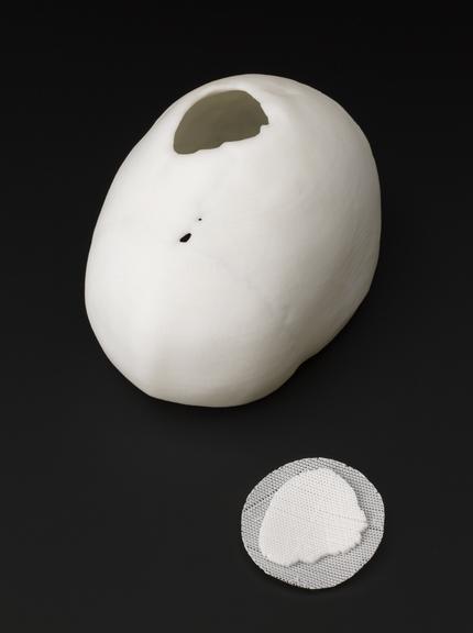 3D printed bone scaffold | Science Museum Group Collection