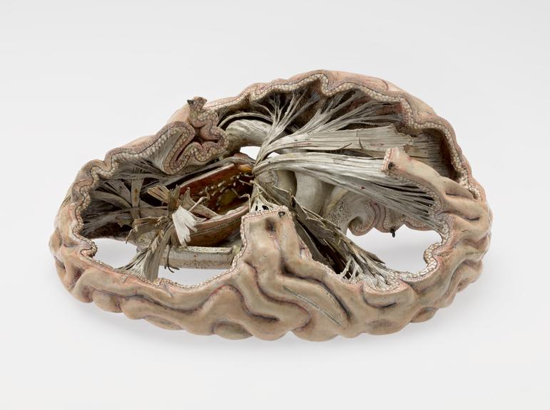 Model of a human brain | Science Museum Group Collection