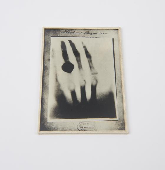 Photograph of a radiograph of hand taken by Wilhelm Conrad Röntgen ...