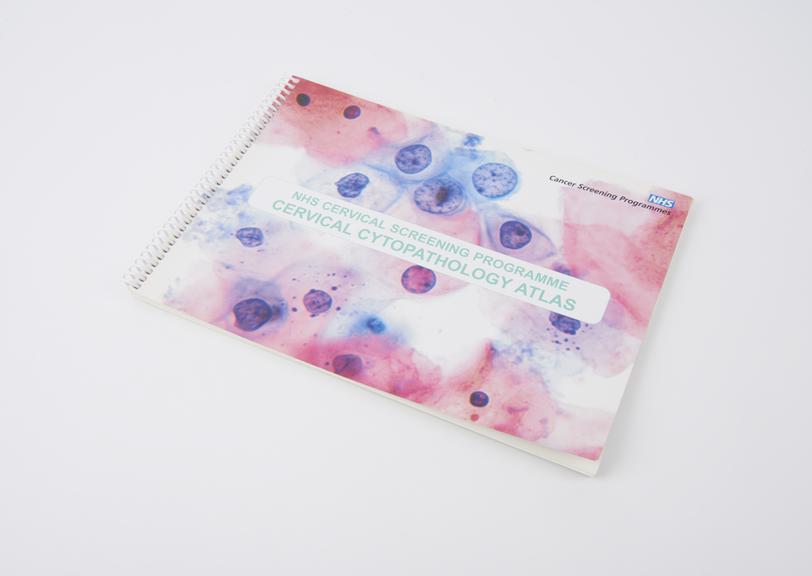 NHS Cervical Screening Pogramme Cervical Cytology Atlas | Science ...