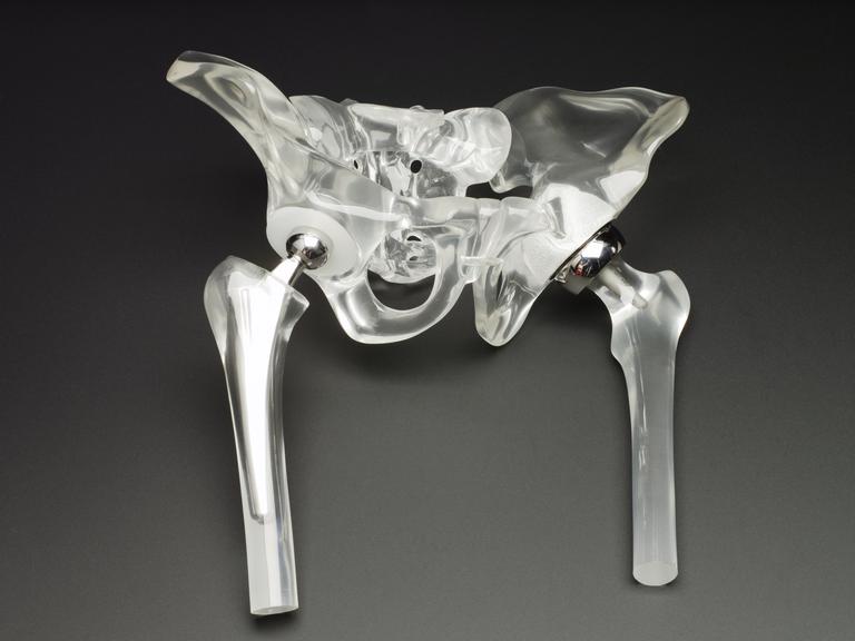 Hip replacement model | Science Museum Group Collection