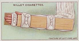 First Aid, Splint | Science Museum Group Collection