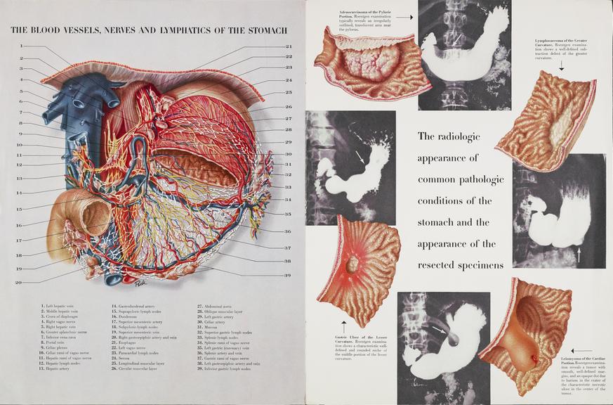 leaflet, medical diagrams | Science Museum Group Collection