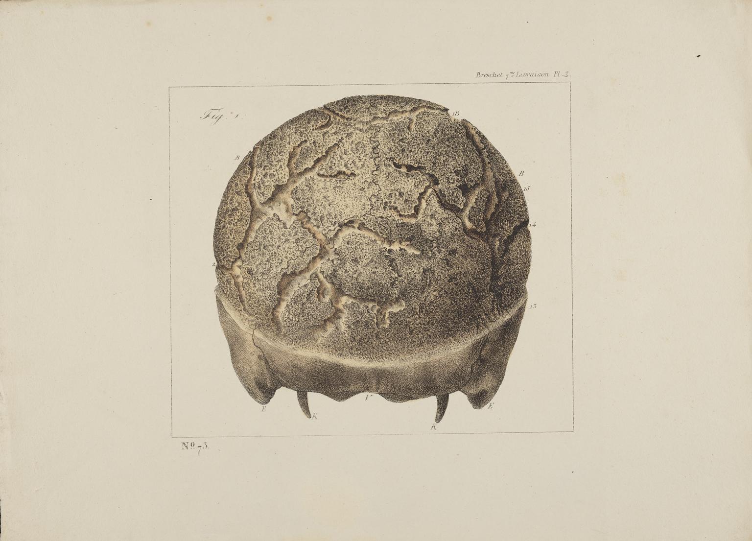 14 Anatomical prints and 4 ‘Explanation of the Plate’ pages | Science ...