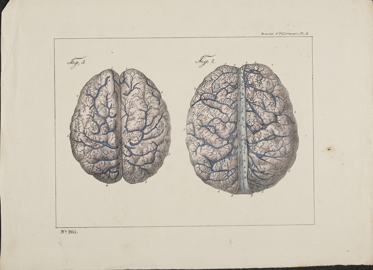 14 Anatomical prints and 4 ‘Explanation of the Plate’ pages | Science ...