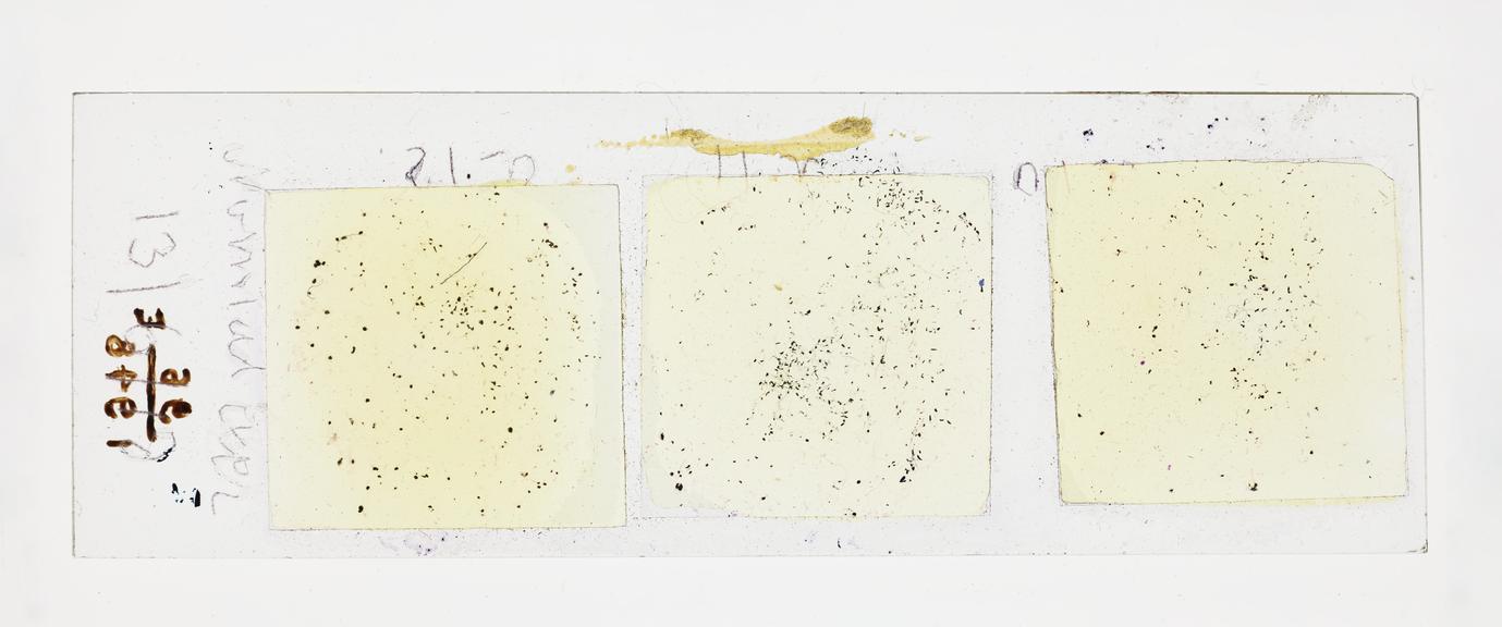 Microscope slide used in research relating to trench fever as ...